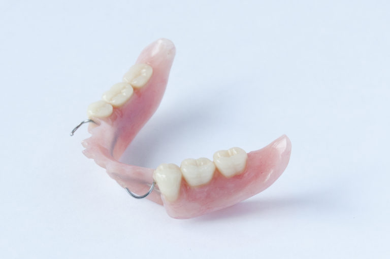 Partiele-prothese - Van der Linden Tandtechniek